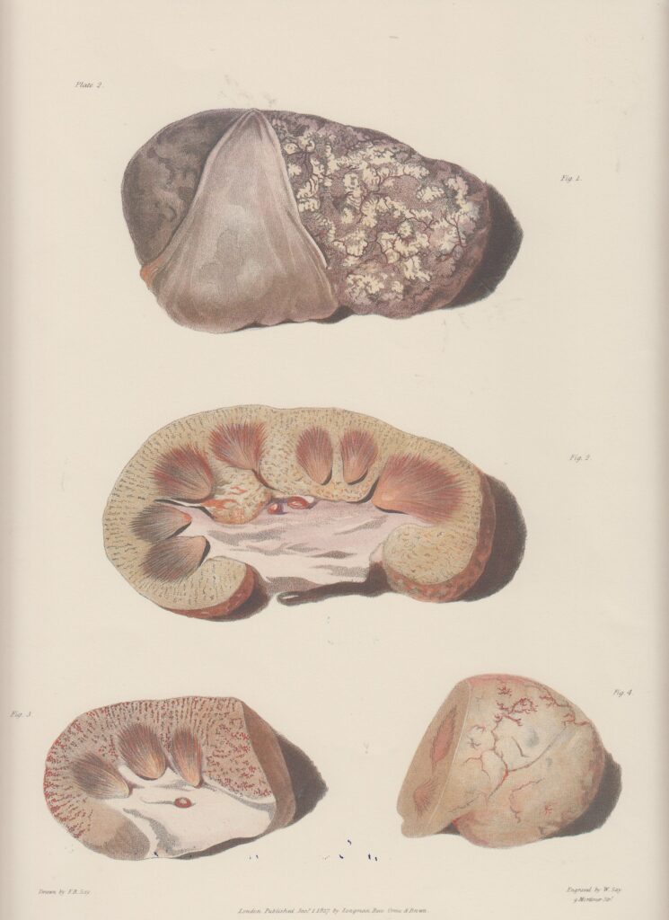 Richard Bright – UK Kidney History