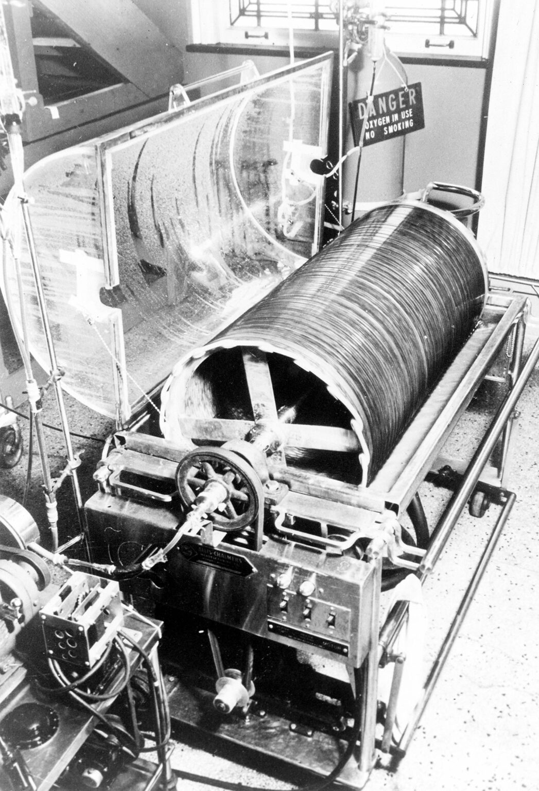 Dialysis technology in the UK 1960-2005 – UK Kidney History
