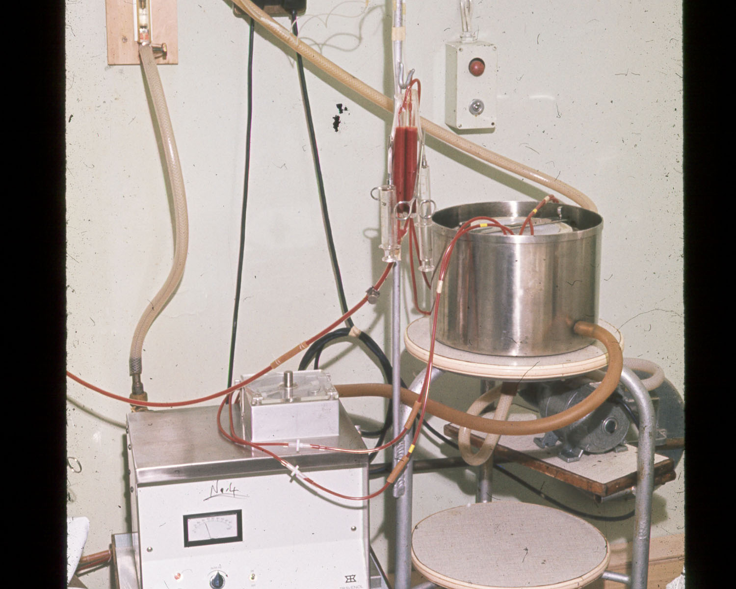 Dialysis technology in the UK 1960-2005 – UK Kidney History