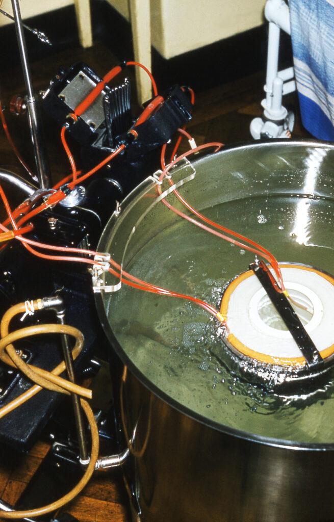 Dialysis technology in the UK 1960-2005 – UK Kidney History