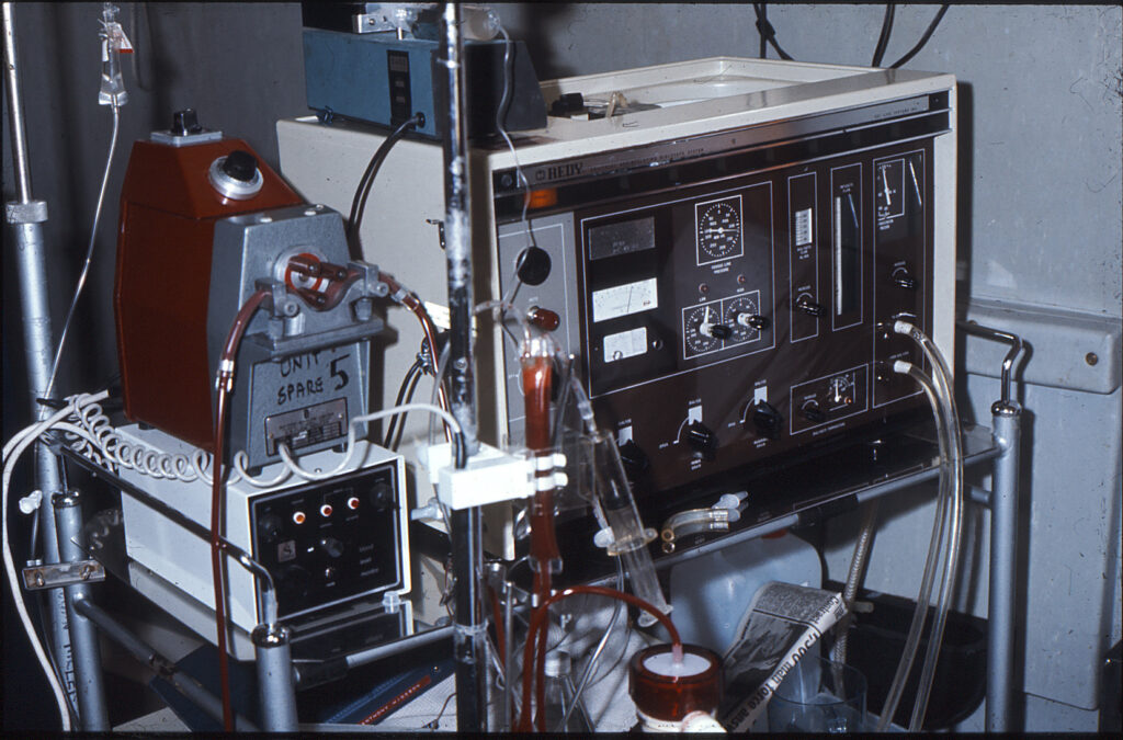 Dialysis technology in the UK 1960-2005 – UK Kidney History
