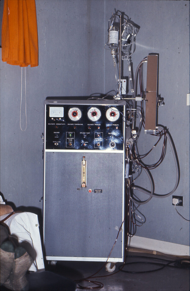 Dialysis technology in the UK 1960-2005 – UK Kidney History