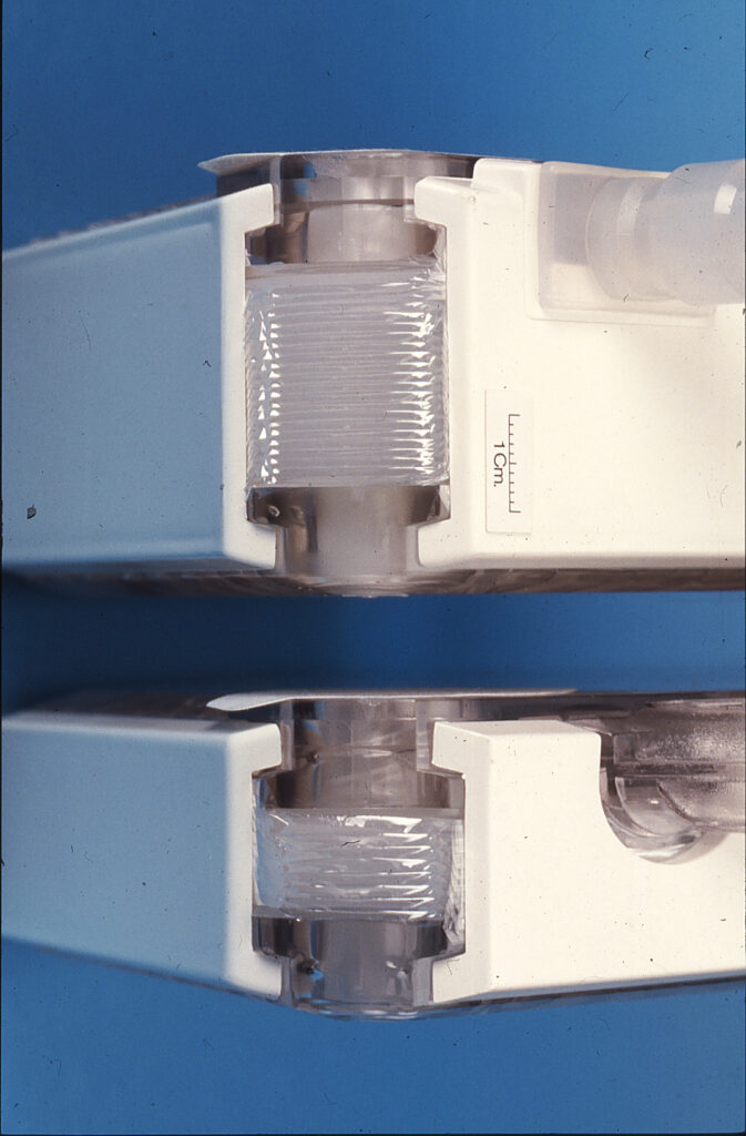 Dialysis technology in the UK 1960-2005 – UK Kidney History