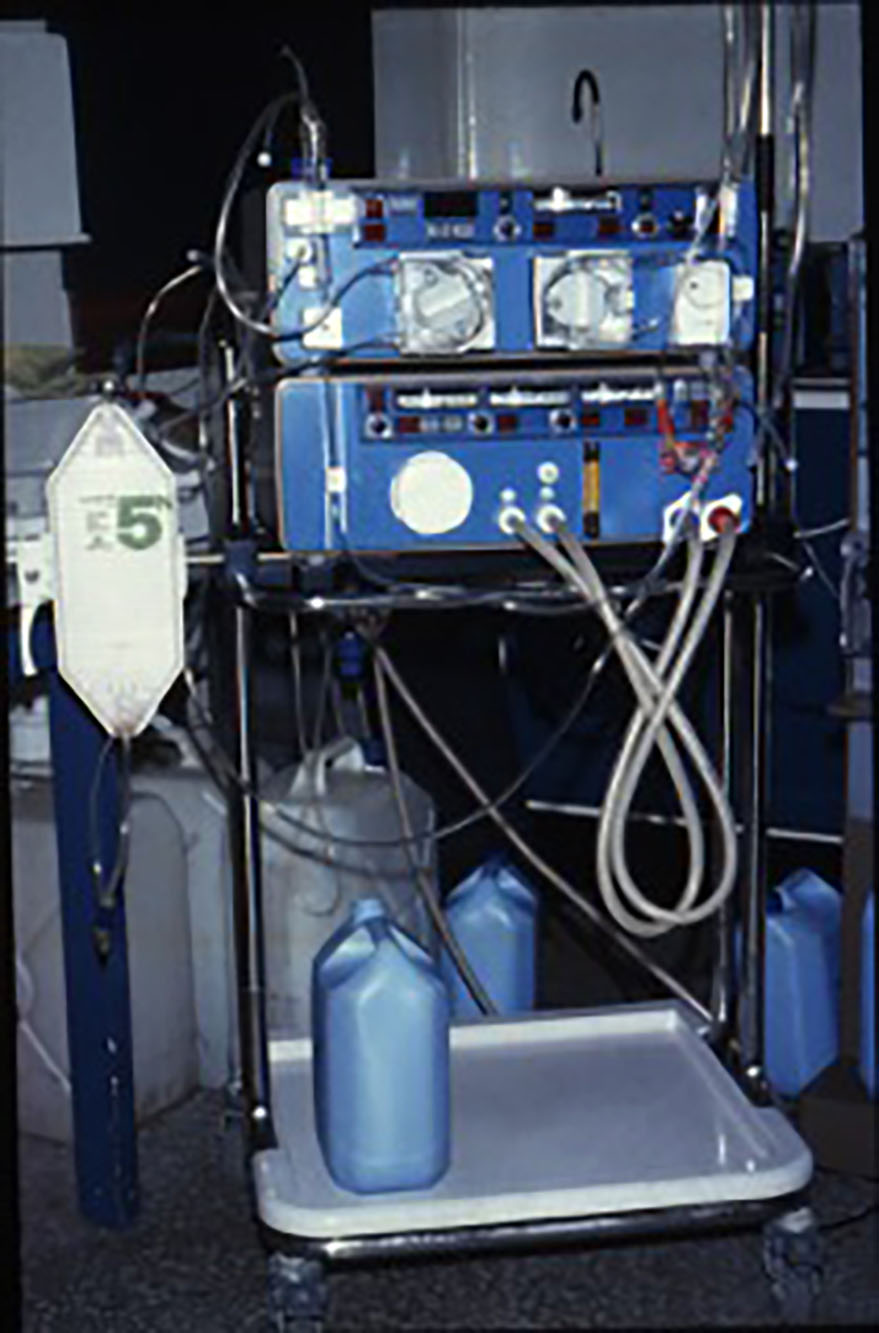 Dialysis technology in the UK 1960-2005 – UK Kidney History